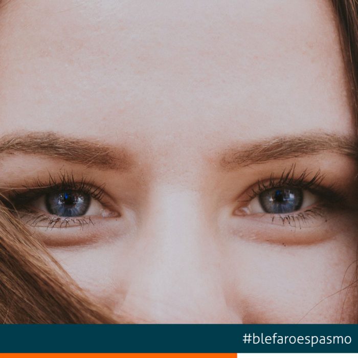 ¿Qué es un Blefaroespasmo? Sintomas y Tratamientos