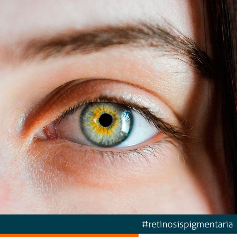 ¿Qué es la retinitis o retinosis pigmentaria? Síntomas y causas
