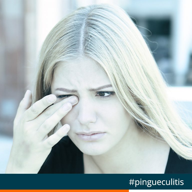 Pingueculitis: Ese punto blanco dentro del ojo | Clinicas Tecnovision